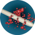 IRRAflow® Advantages - IRRAflow