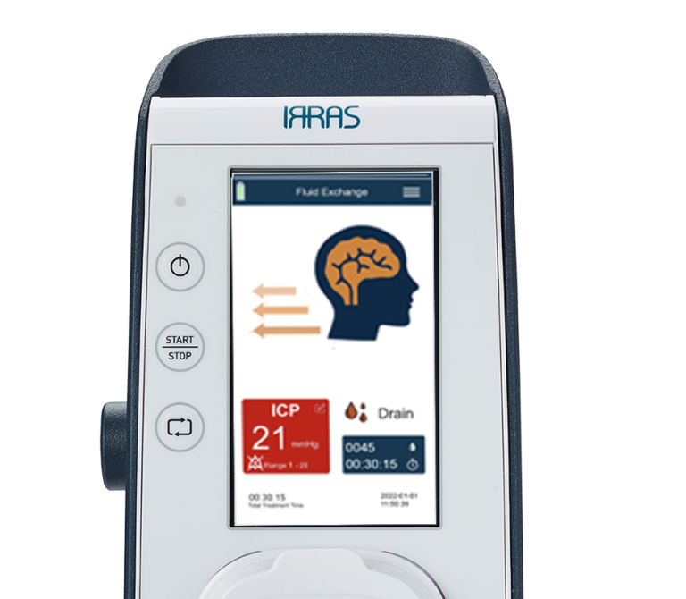 IRRAflow® Advantages - IRRAflow