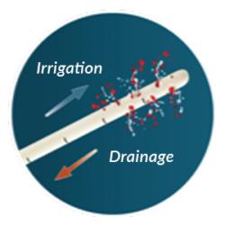 Introducing IRRAflow® - IRRAflow